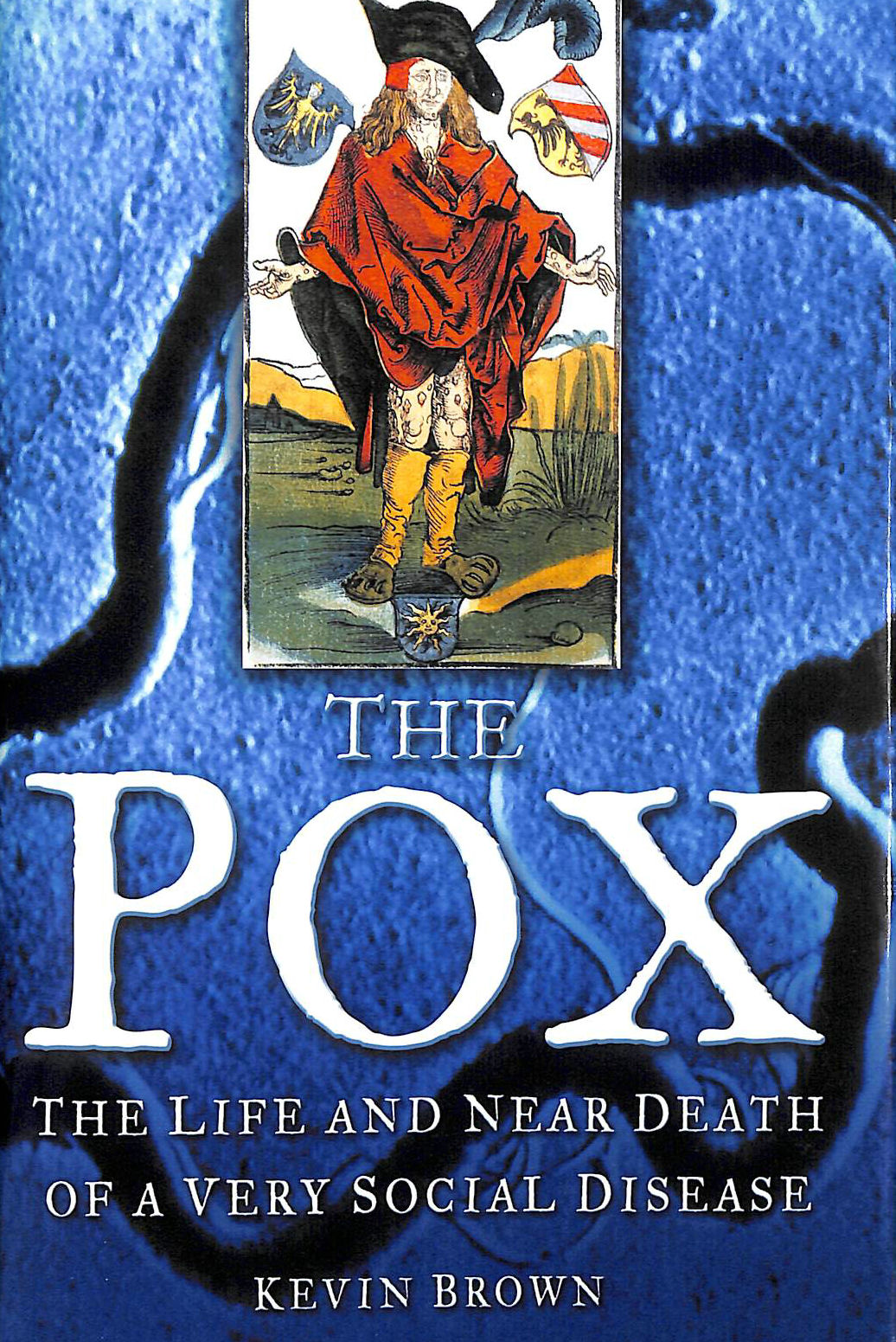 The Pox: The Life and Near Death of a Very Social Disease